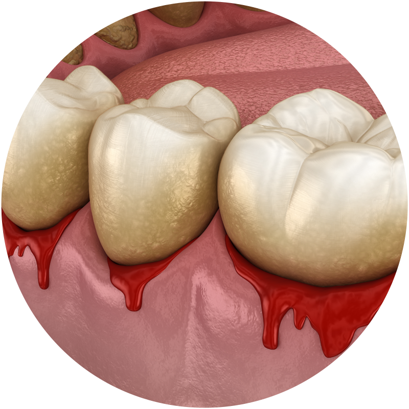 Herbal Toothpaste - Edible Toothpaste | Edinora